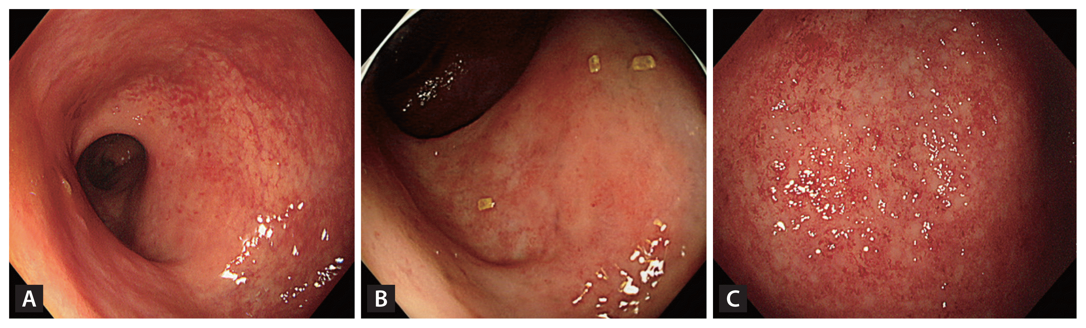 The Korean Journal of Internal Medicine